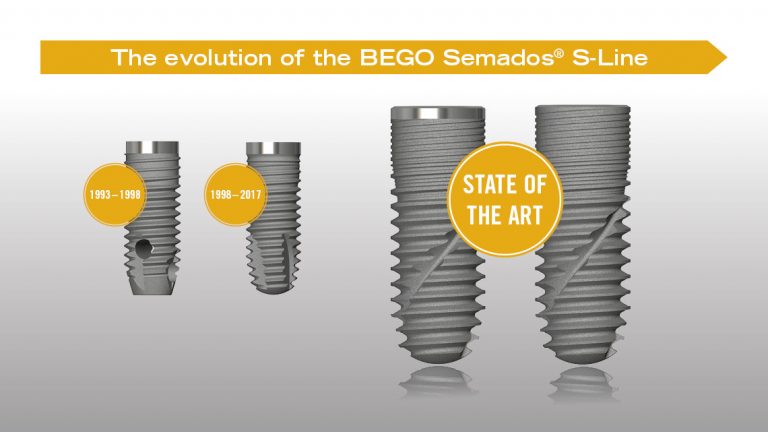 BEGO Semados® SC/SCX-Implants – MRDENTAL d.o.o. Bihać